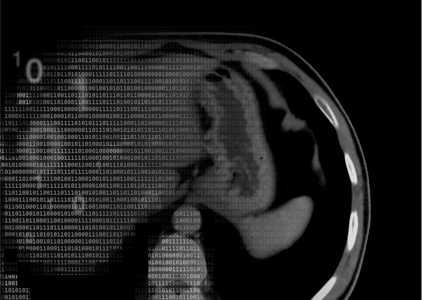 uCT 760 (Z-Detector+ 3D Iterative Denoising) | United-Imaging
