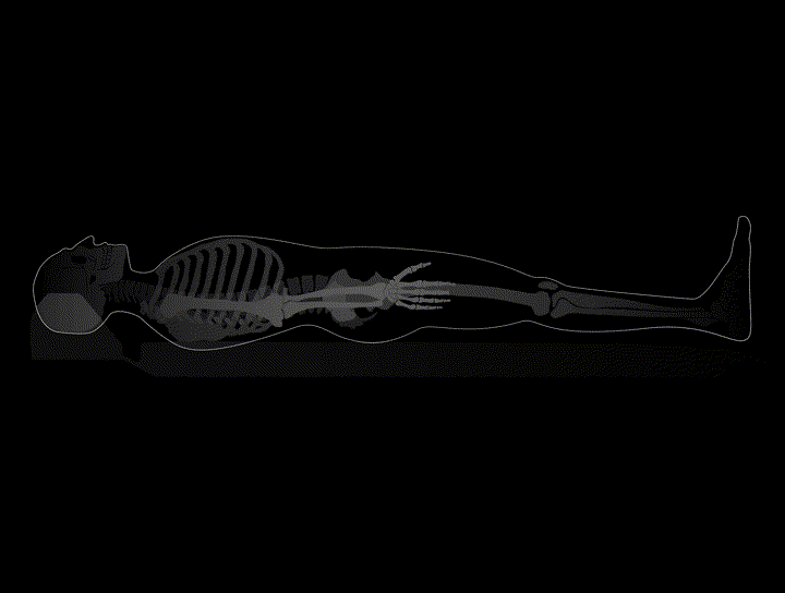 uCT® 550 - United Imaging