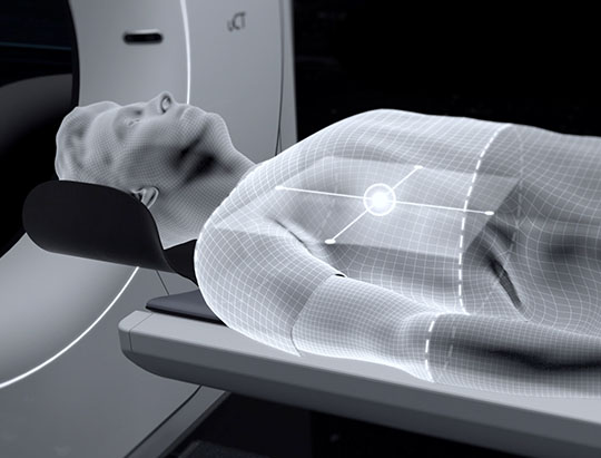 uCT® ATLAS - United Imaging