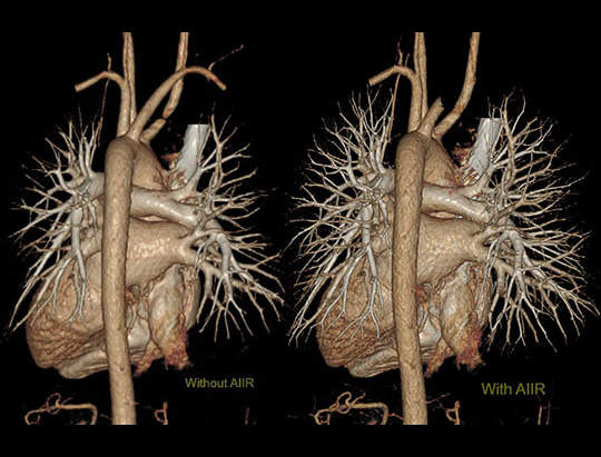 uCT® ATLAS - United Imaging